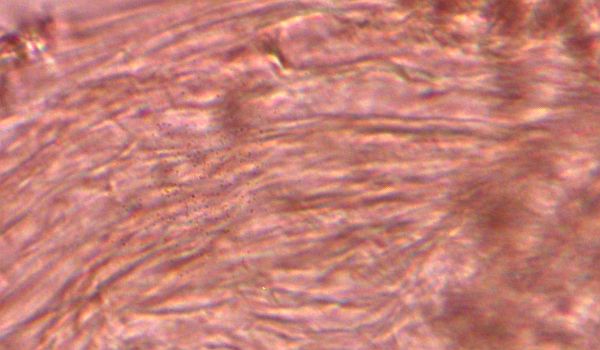 Hygrocybe subpapillata, Papillate Waxcap mushroom, identification